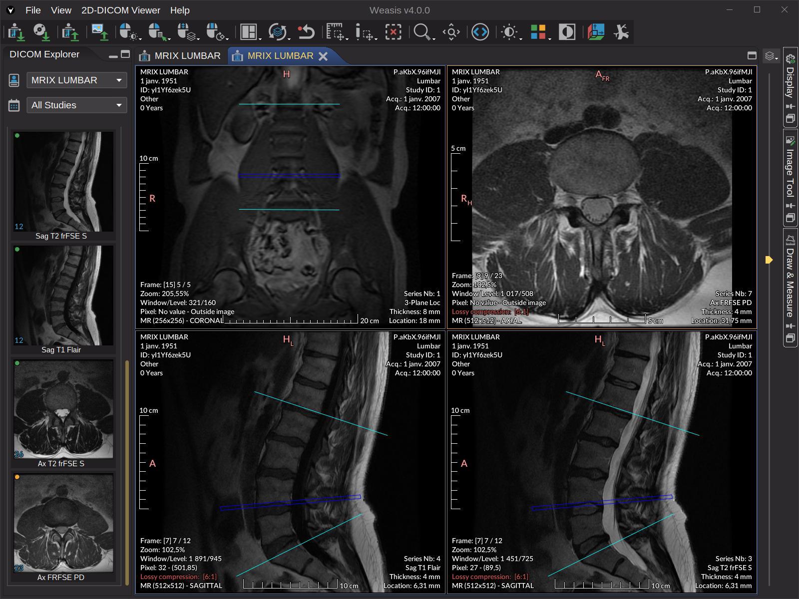 Weasis: Free DICOM viewer :: Weasis Documentation